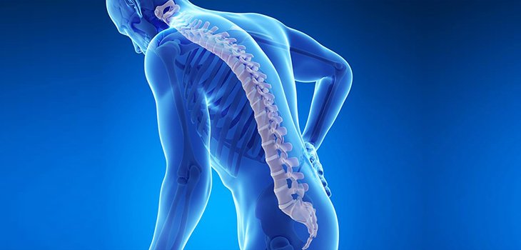 Osteoporosis: The Silent Disease Affecting Millions - Aspen Fusion